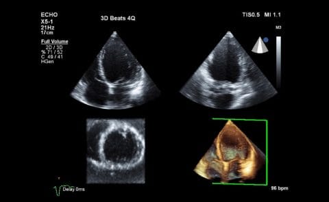 3D & 4D Echocardiography - NSW Cardiology